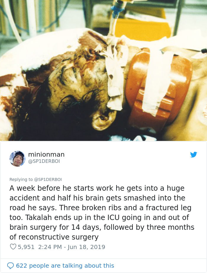 Man Given 0.1% Chance By Doctors After Motorbike Accident Where He Lost ...