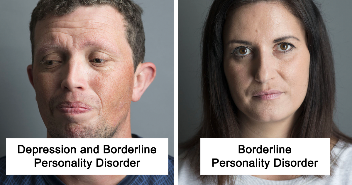 Faces And Stories Of People With Mental Or Physical Illnesses: 16 ...