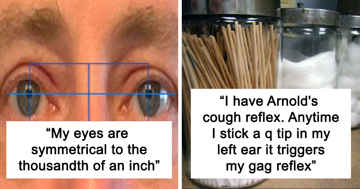 Only People With Rare Body Features Joined This Thread And Shared 35 Of ...