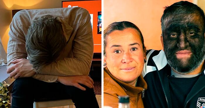 50 Photos Of Unique People That Show That Genetics Is Hard To Predict ...