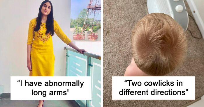 50 Photos Of Unique People That Show That Genetics Is Hard To Predict ...