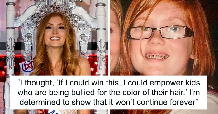 Woman Who Was “Spat At” And “Burned” At School For Having Ginger Hair ...