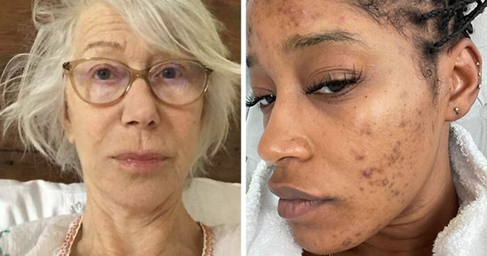 30 Instances Famous People Posted Photos Without Any Filters Or Retouching