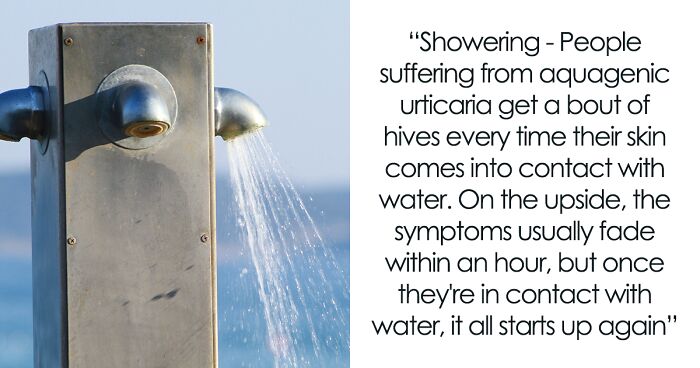 40 Weird Allergies That Might Sound Unbelievable But Are Real