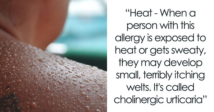 40 Weird Allergies That Might Sound Unbelievable But Are Real