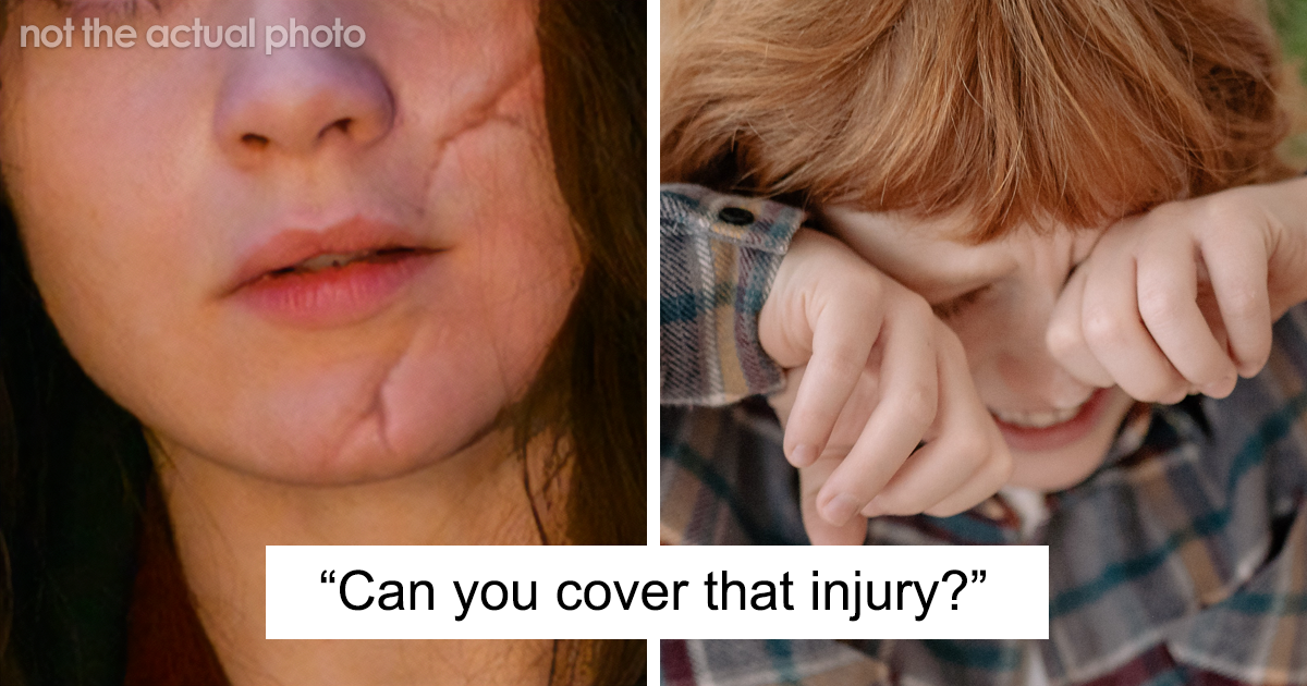 “Am I The Jerk For Leaving Significant Facial Scarring Uncovered On A ...