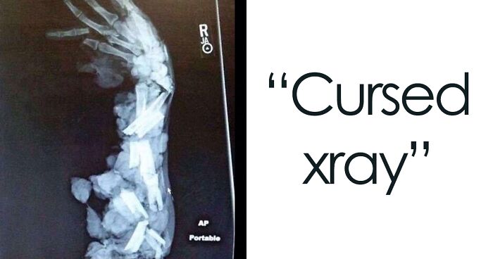 50 Times People Saw Such ‘Cursed’ Images, They Just Had To Share Them ...