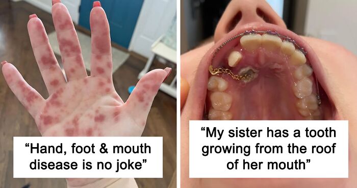 The “Make Me Suffer” Community Posts Unsettling Pics No One Wants To ...