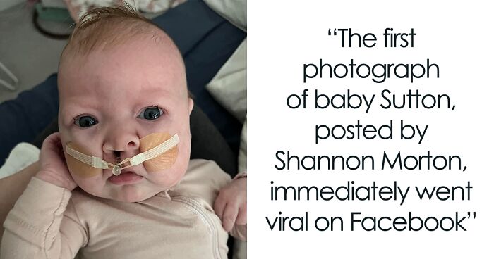 The Heart-Warming Story Of One Photograph: An Image Of A Baby With A ...