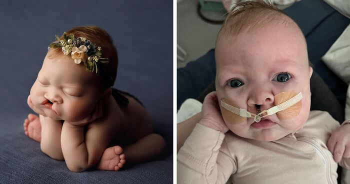 The Heart-Warming Story Of One Photograph: An Image Of A Baby With A ...