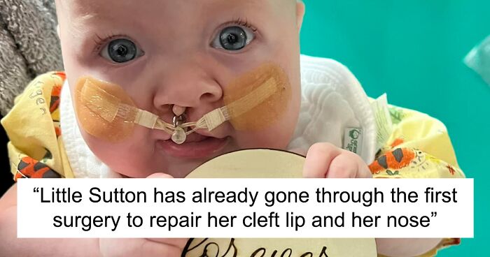 The Heart-Warming Story Of One Photograph: An Image Of A Baby With A ...
