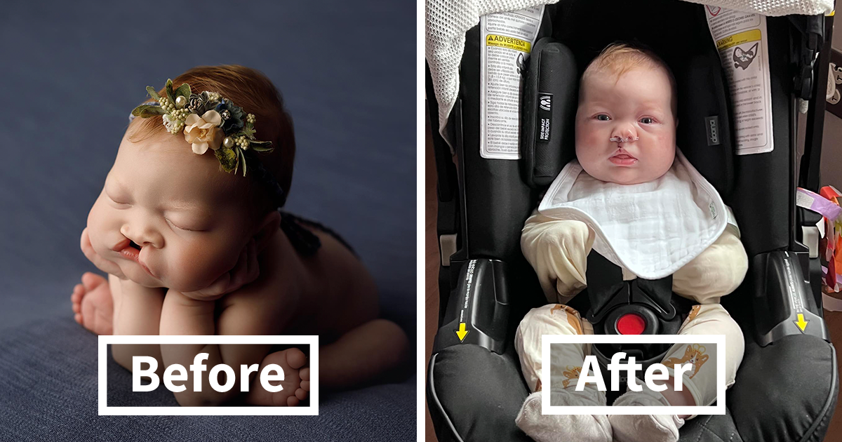 The Heart-Warming Story Of One Photograph: An Image Of A Baby With A ...