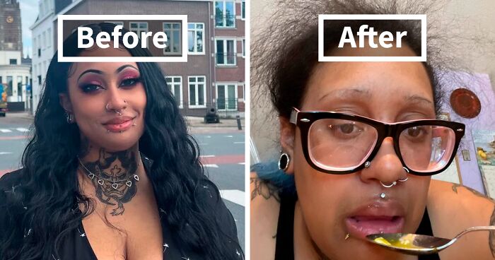 30 Funny Before & After Pics You Might Find Hard To Believe Show The ...