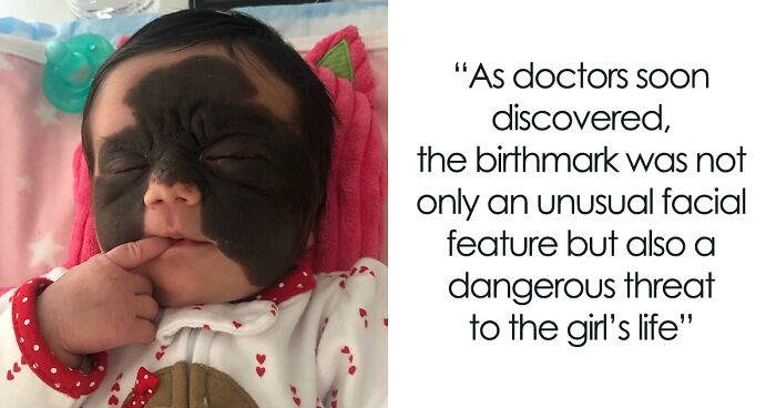 This 4-Year-Old Girl Has Undergone Multiple Surgeries To Get A ...