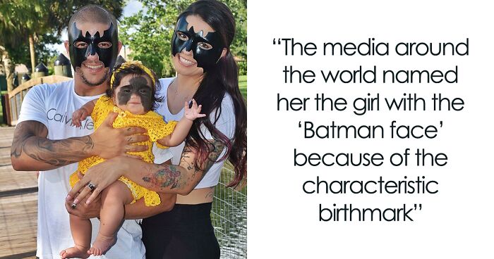 This 4-Year-Old Girl Has Undergone Multiple Surgeries To Get A ...