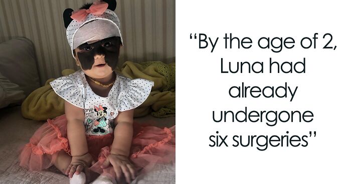 This 4-Year-Old Girl Has Undergone Multiple Surgeries To Get A ...