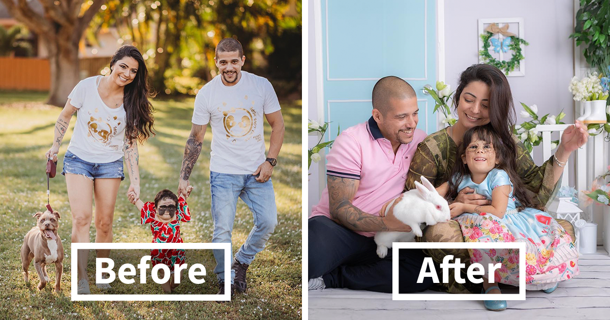 This 4-Year-Old Girl Has Undergone Multiple Surgeries To Get A ...