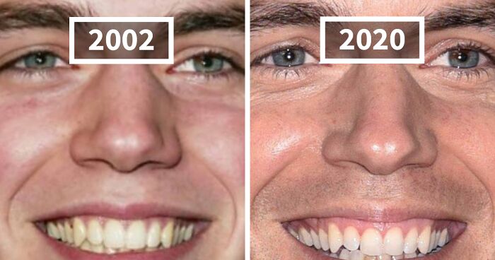 34 Pics That Show How Much Or How Little Celebrity Faces Have Changed ...