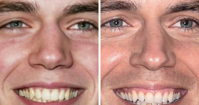 34 Pics That Show How Much Or How Little Celebrity Faces Have Changed ...