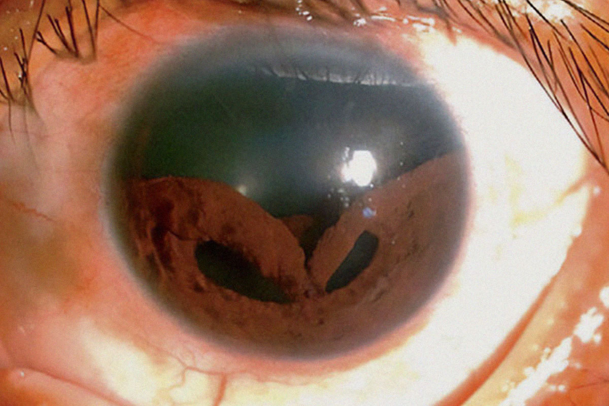 40 Bizarre And Inspiring Medical Cases That People Shared On This ...