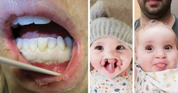 40 Bizarre And Inspiring Medical Cases That People Shared On This ...