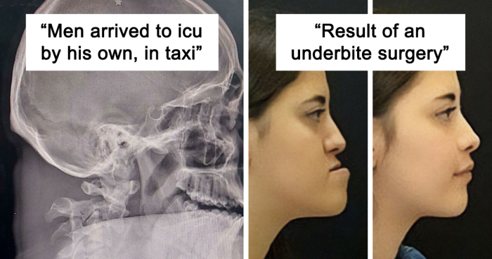 40 Bizarre And Inspiring Medical Cases That People Shared On This ...