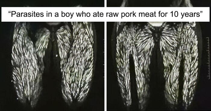 40 Bizarre And Inspiring Medical Cases That People Shared On This ...