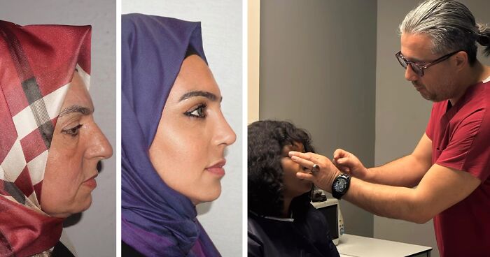 Before And After Photos From Turkish Plastic Surgery Clinic Have Left ...