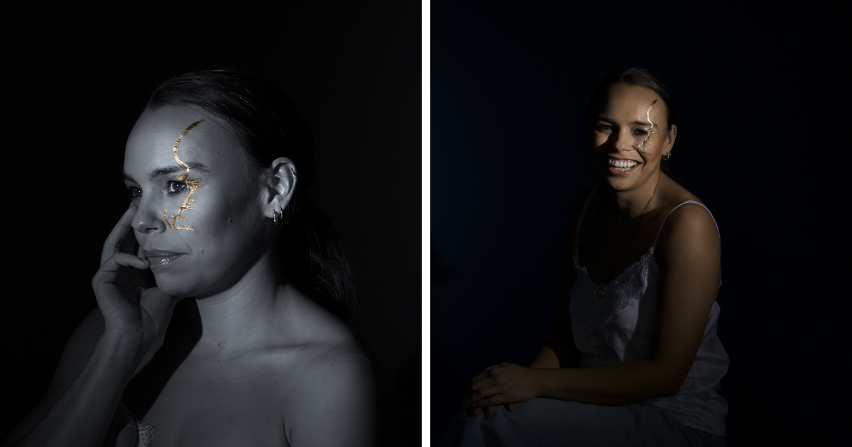 Kintsugi Beauty: Celebrating The Beauty Of Scars And Imperfections In ...