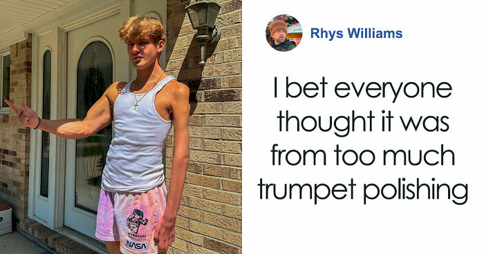 19-Year-Old Stuns People Online After Revealing Reason Why Right Arm ...
