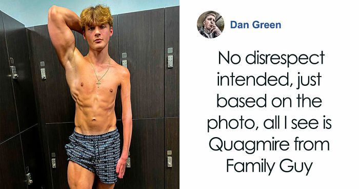 19-Year-Old Stuns People Online After Revealing Reason Why Right Arm ...