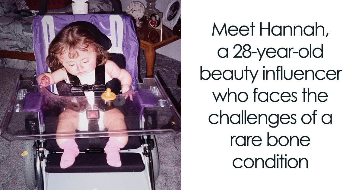 This Resilient Woman Became A Beauty Influencer Despite Her Disability ...