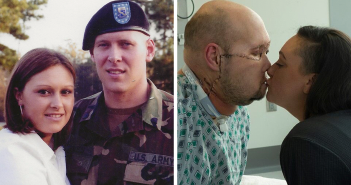 “I Don’t Want To Wear A Mask”: Veteran Who Lost Half Of His Face ...