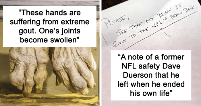 35 Morbid Facts That Might Teach You Something New Or Ruin Your Day ...