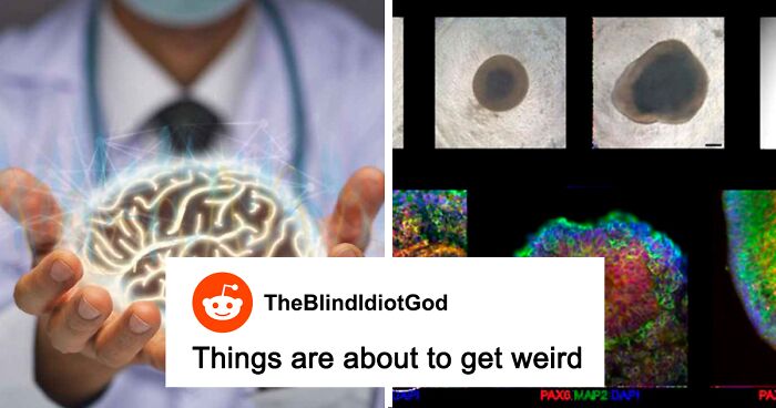 “Things Are About To Get Weird”: Scientists Use Human Brain Cells On ...