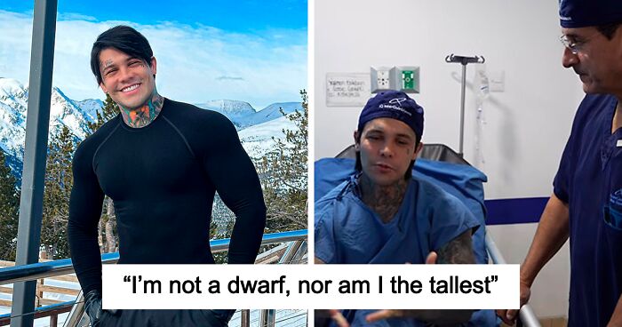 Influencer Spends $175,000 On “Most Painful” Leg-Lengthening Surgery To ...