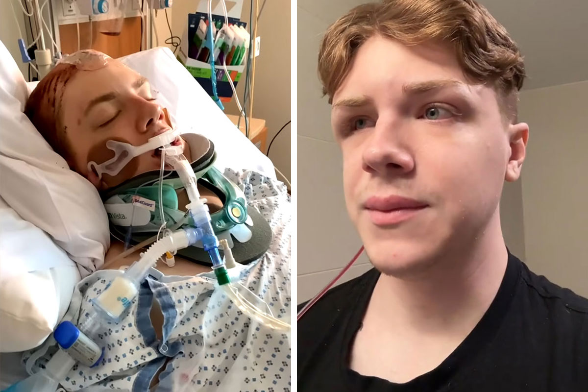 Man Who Underwent Skull Removal Surgeries To “Wash” His Brain Gets ...