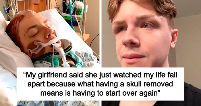 Man Who Underwent Skull Removal Surgeries To “Wash” His Brain Gets ...
