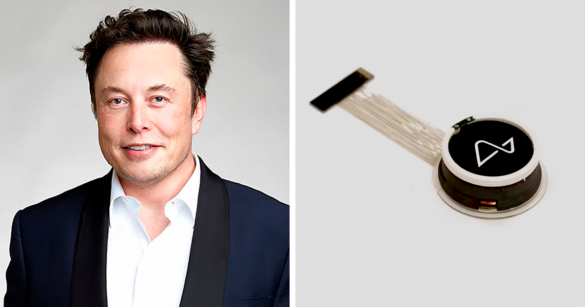 “That Is The Goal”: Elon Musk’s Neuralink Is Implanted In First-Ever ...