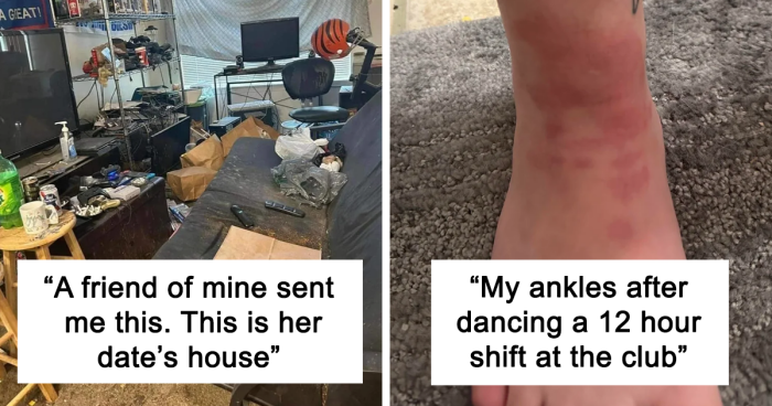 35 Disturbing Photos That Made People Suffer (New Pics)