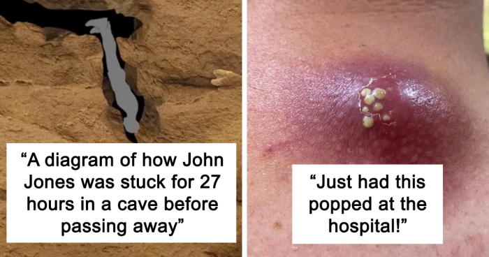 35 Disturbing Photos That Made People Suffer (New Pics)