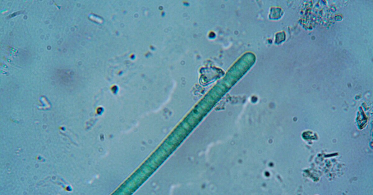 Worms Living In Chernobyl Exclusion Zone Have Super Ability That Humans ...