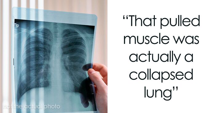 35 Things People Assumed Were Normal About Their Bodies Until Someone ...