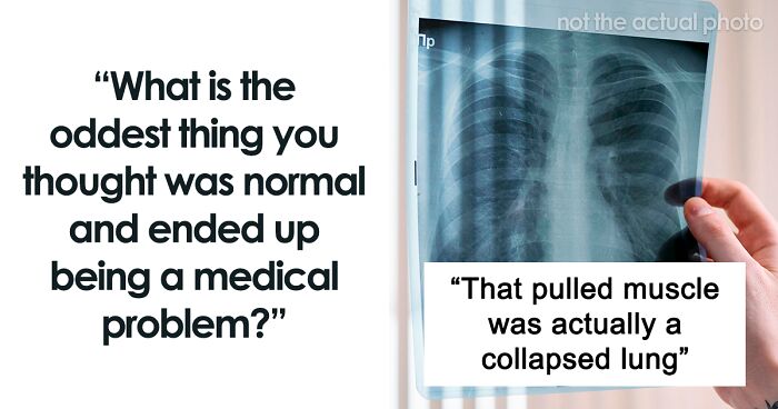 35 Things People Assumed Were Normal About Their Bodies Until Someone ...