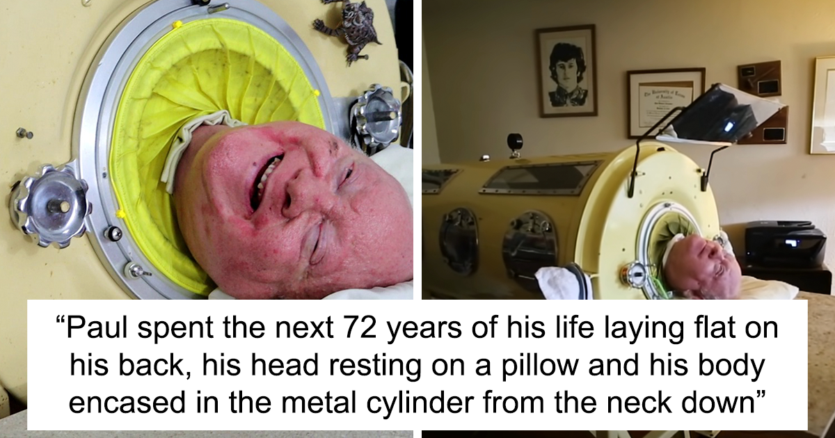 “Polio Paul” Passes Away After Spending 70 Years In Iron Lung, Leaves ...