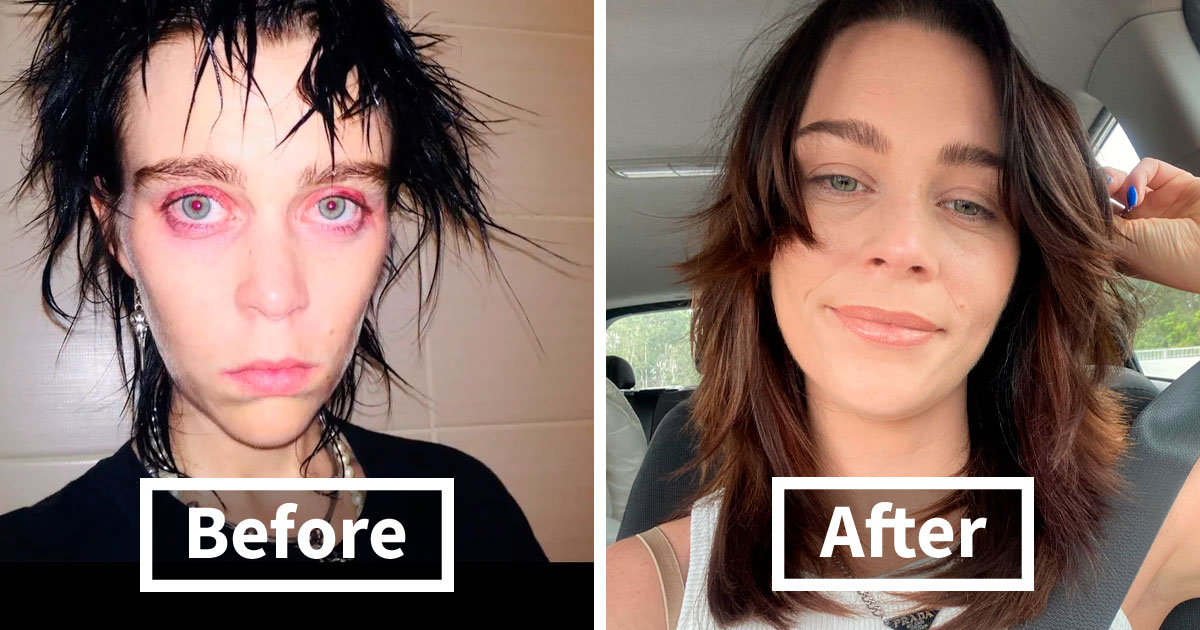 50 Before And After Pictures That Show What Happens When People ...