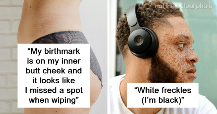 40 People Share The Weirdest Things About Their Bodies | Bored Panda