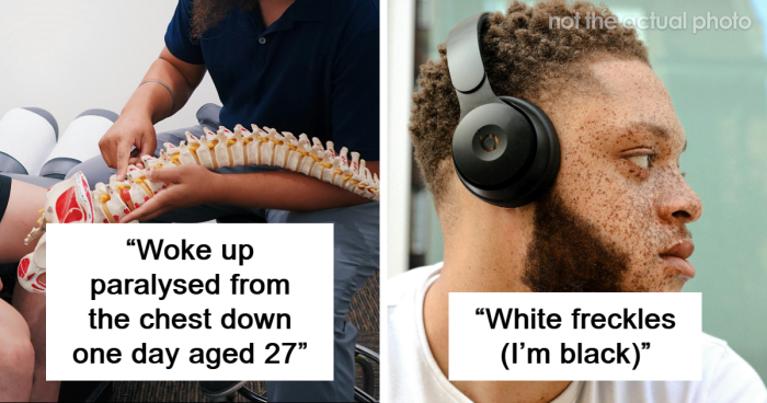 40 People Share The Weirdest Things About Their Bodies | Bored Panda