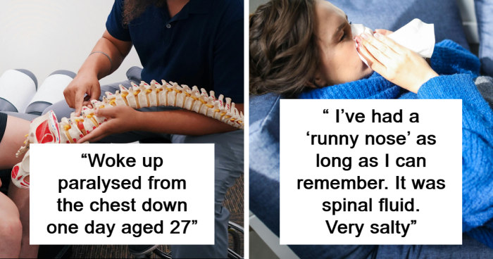 40 People Share The Weirdest Things About Their Bodies | Bored Panda