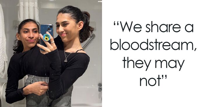 Conjoined Twins Speak Out After Viral Photos Leave People With A ...